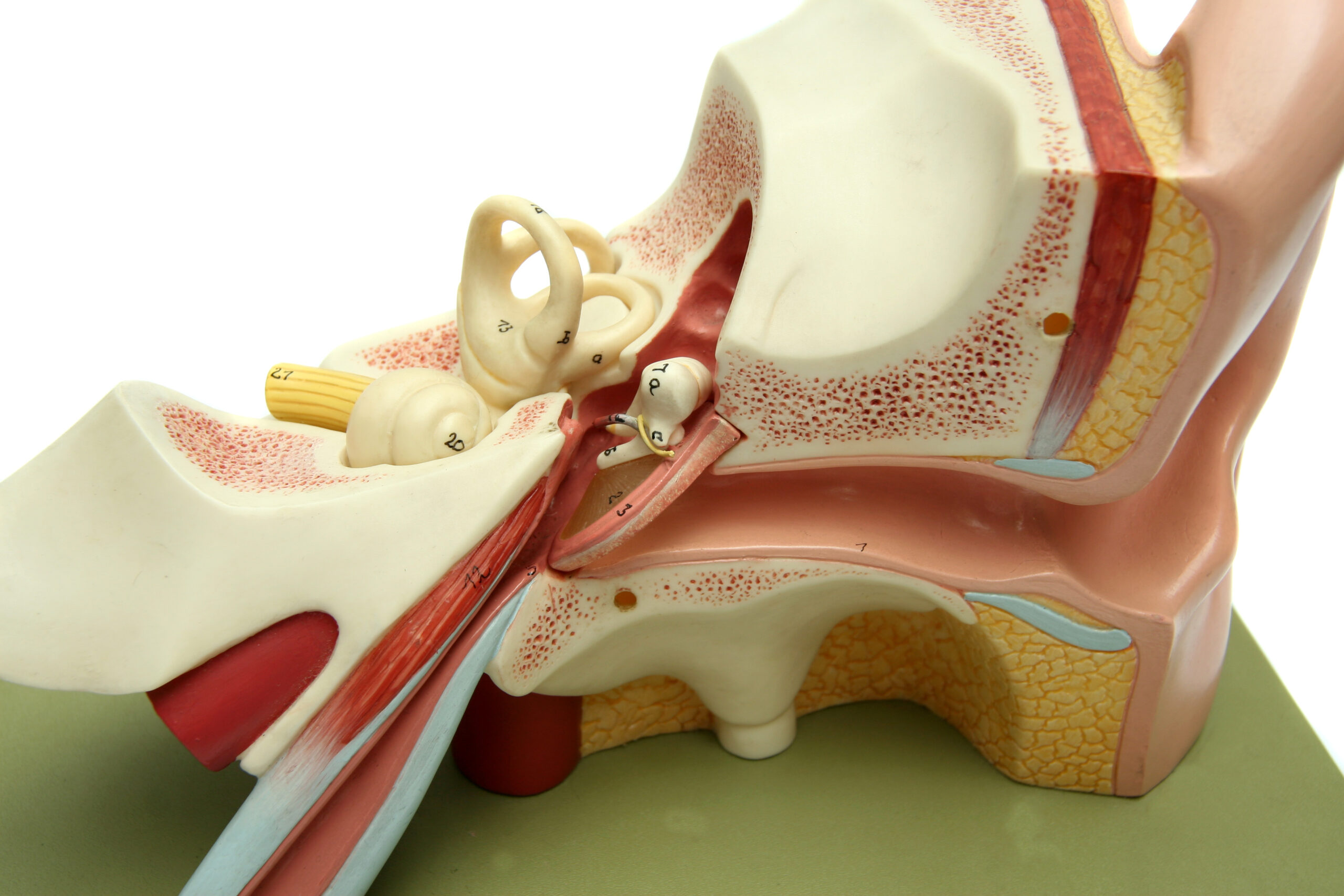 Journey of a Cochlear Implant Patient - Cochlear Implants Singapore